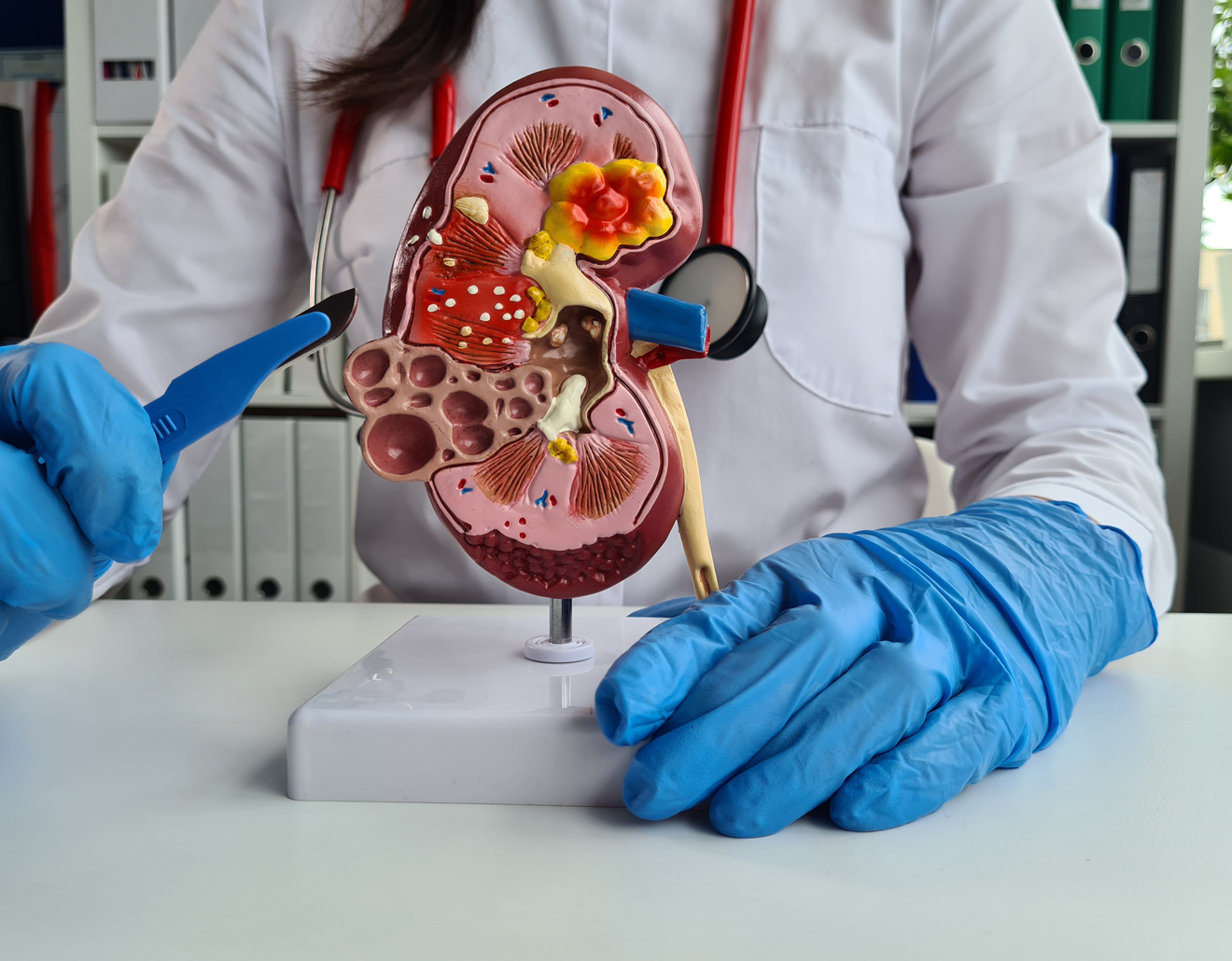 Chirurgie Urologique et rénale - Clinique Méditerranéenne